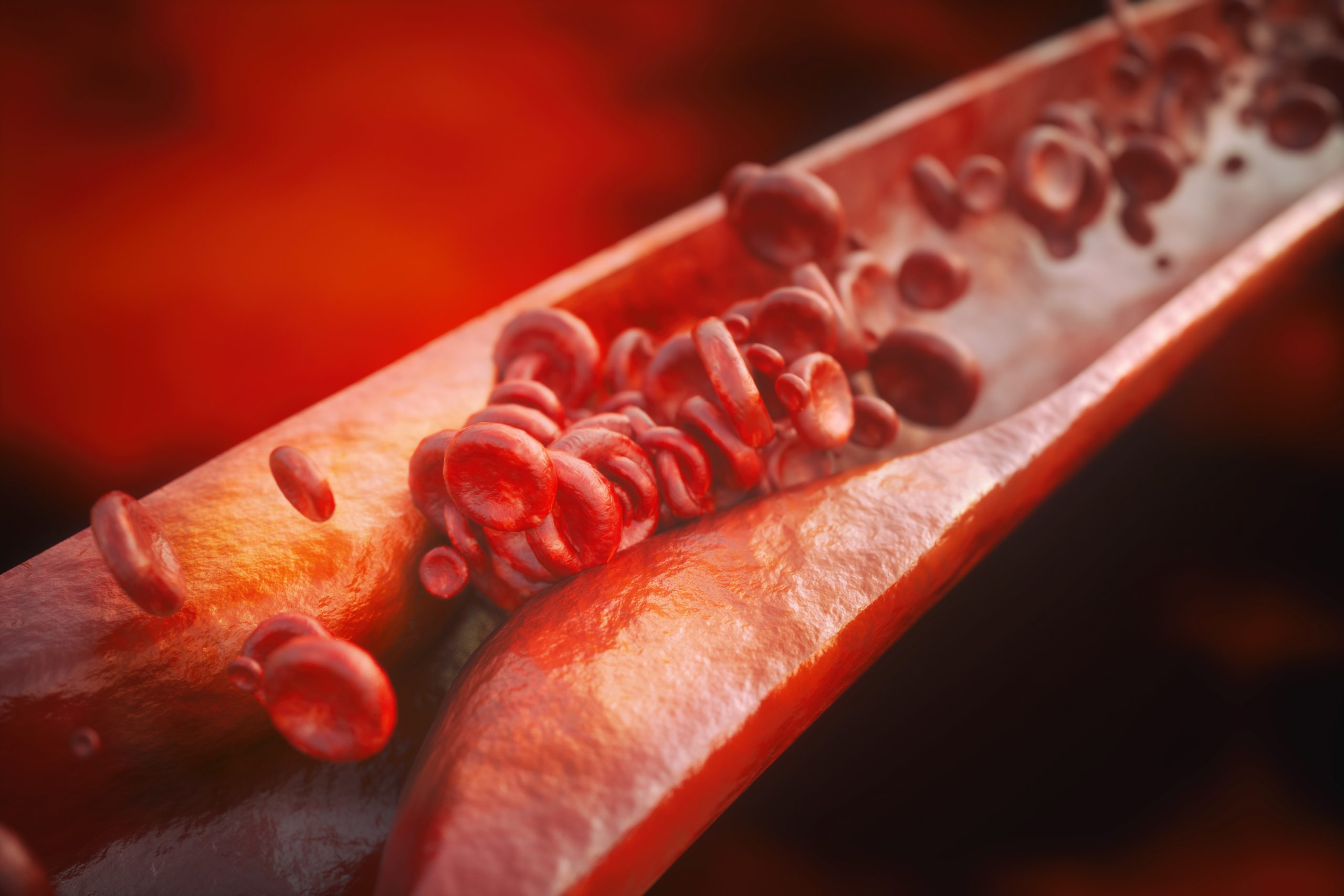 Lipid modification for CVD in primary care